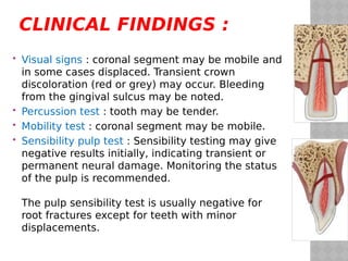 traumatic injuries to teeth | PDF