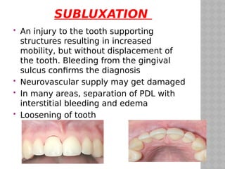 traumatic injuries to teeth | PDF