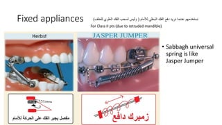 functional appliances | PDF