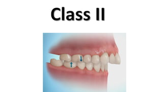 functional appliances | PDF