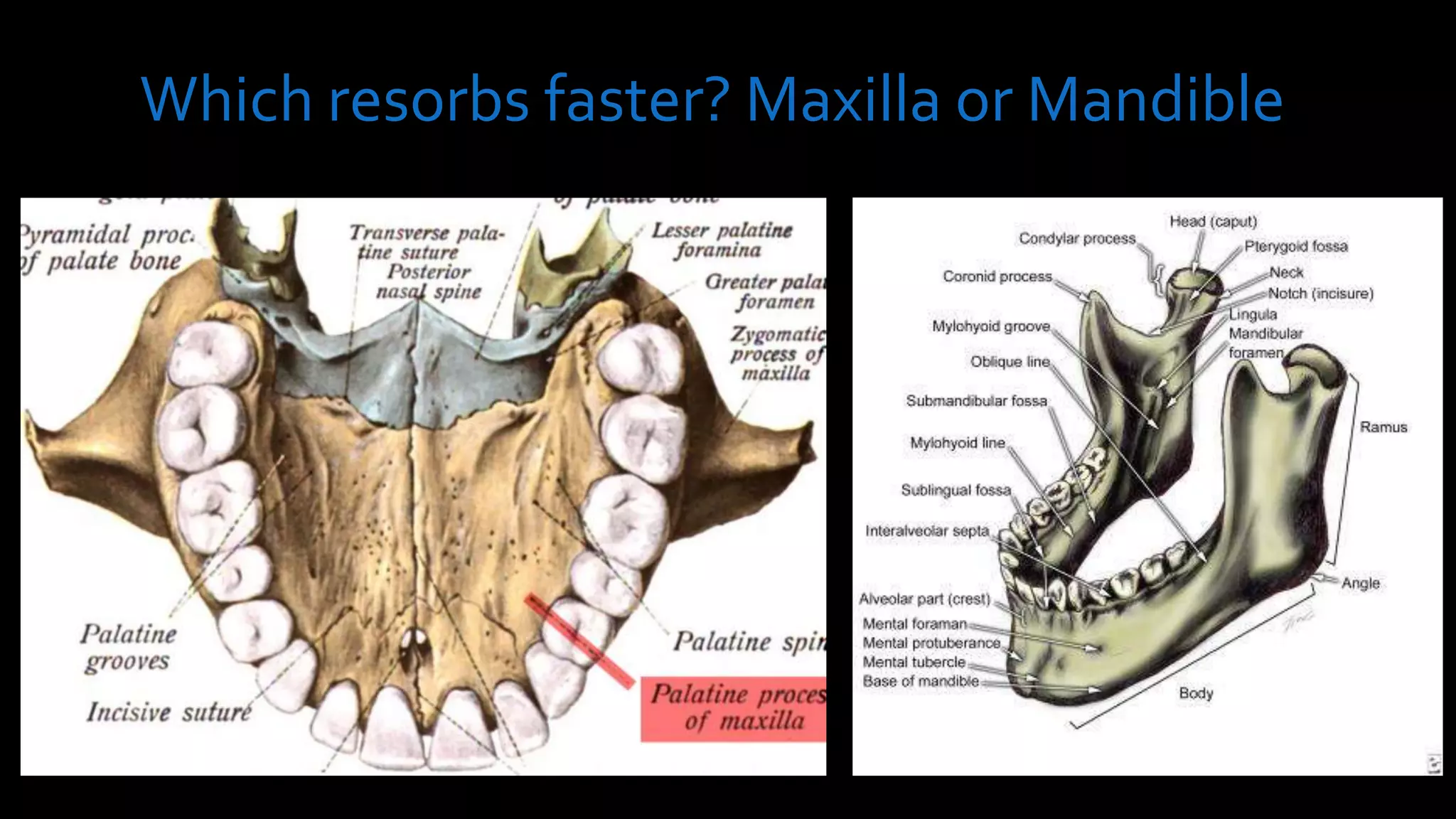 Pre-Prosthetic Surgeries | PPTX