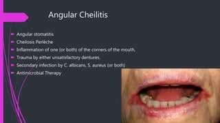 Diseases of the Lips, Swellings of the Face and Neck | PPTX