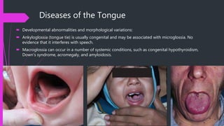 Diseases of the Lips, Swellings of the Face and Neck | PPTX