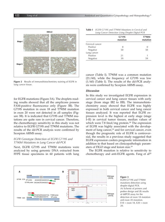 Highly Sensitive Droplet Digital Pcr For The Detection Of Egfr G719s