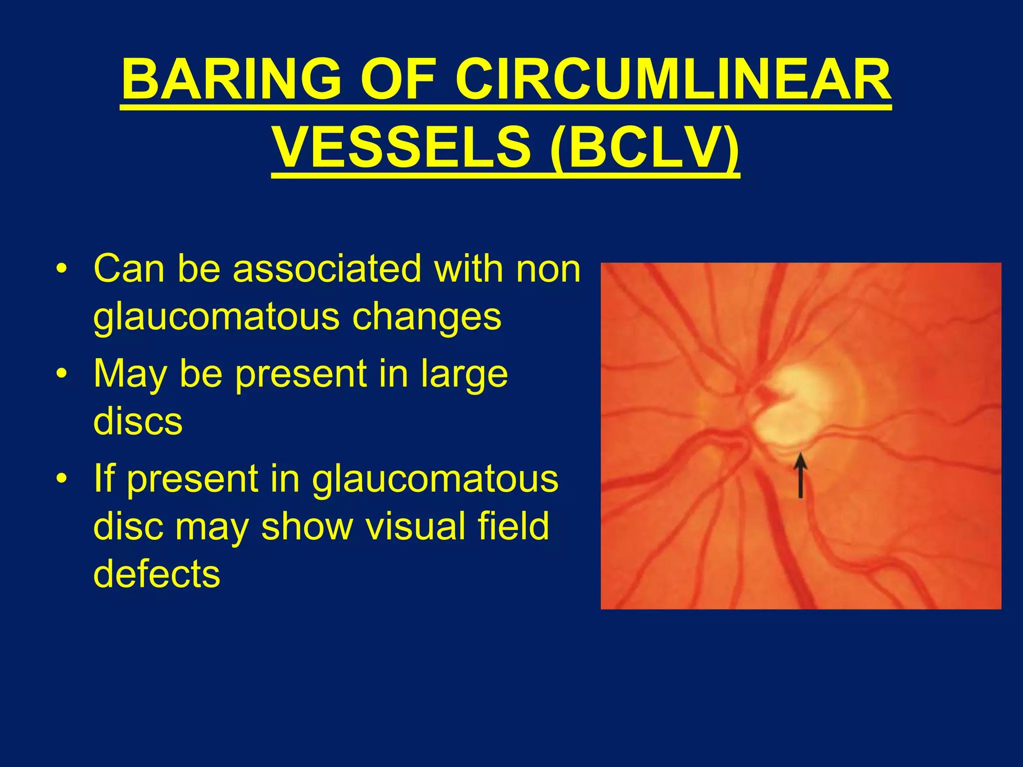 Clinical evaluation of optic disc changes | PPT