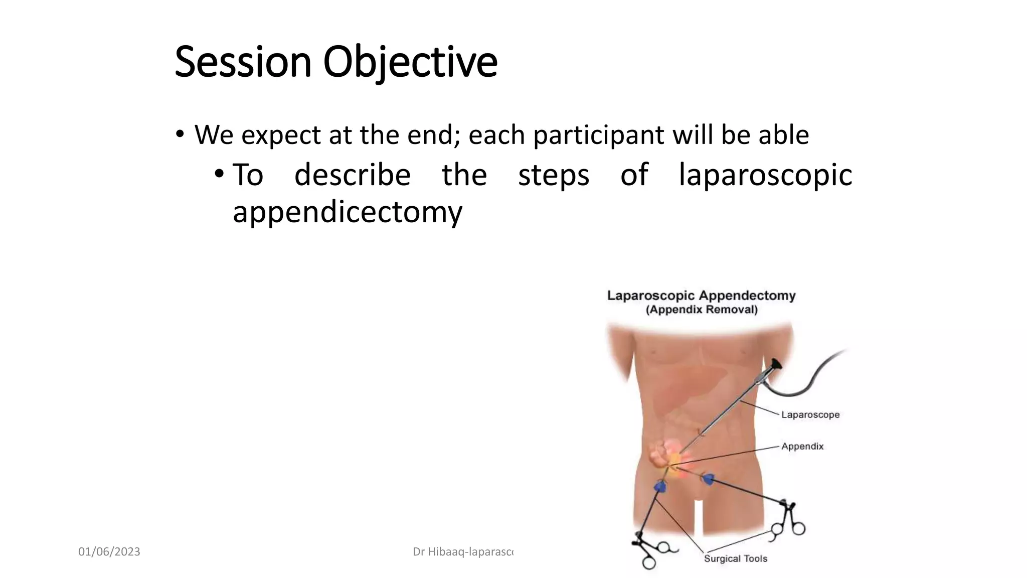 16. laparascopic appendectomy 1.pptx