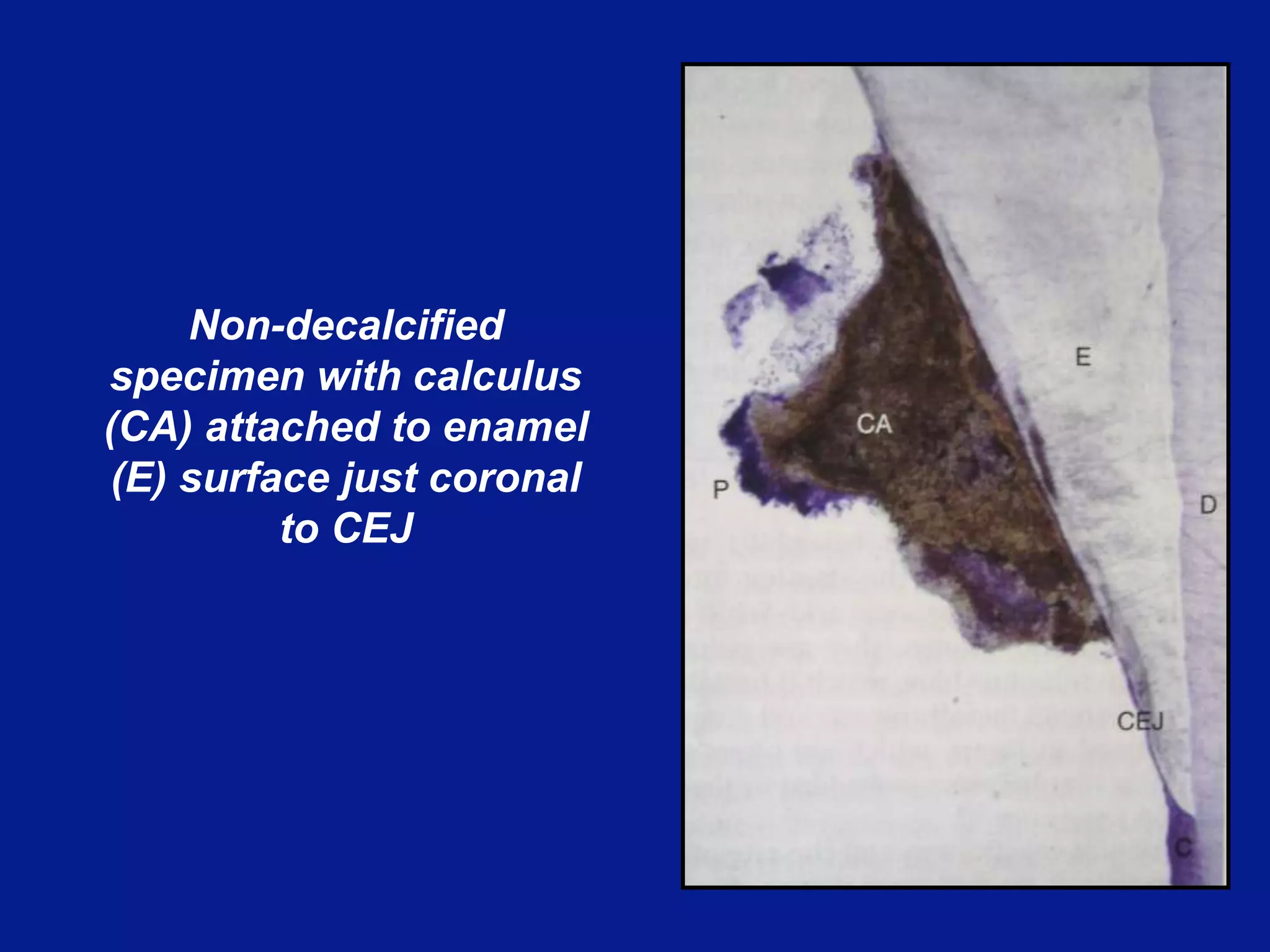 16.Role of dental calculus.ppt