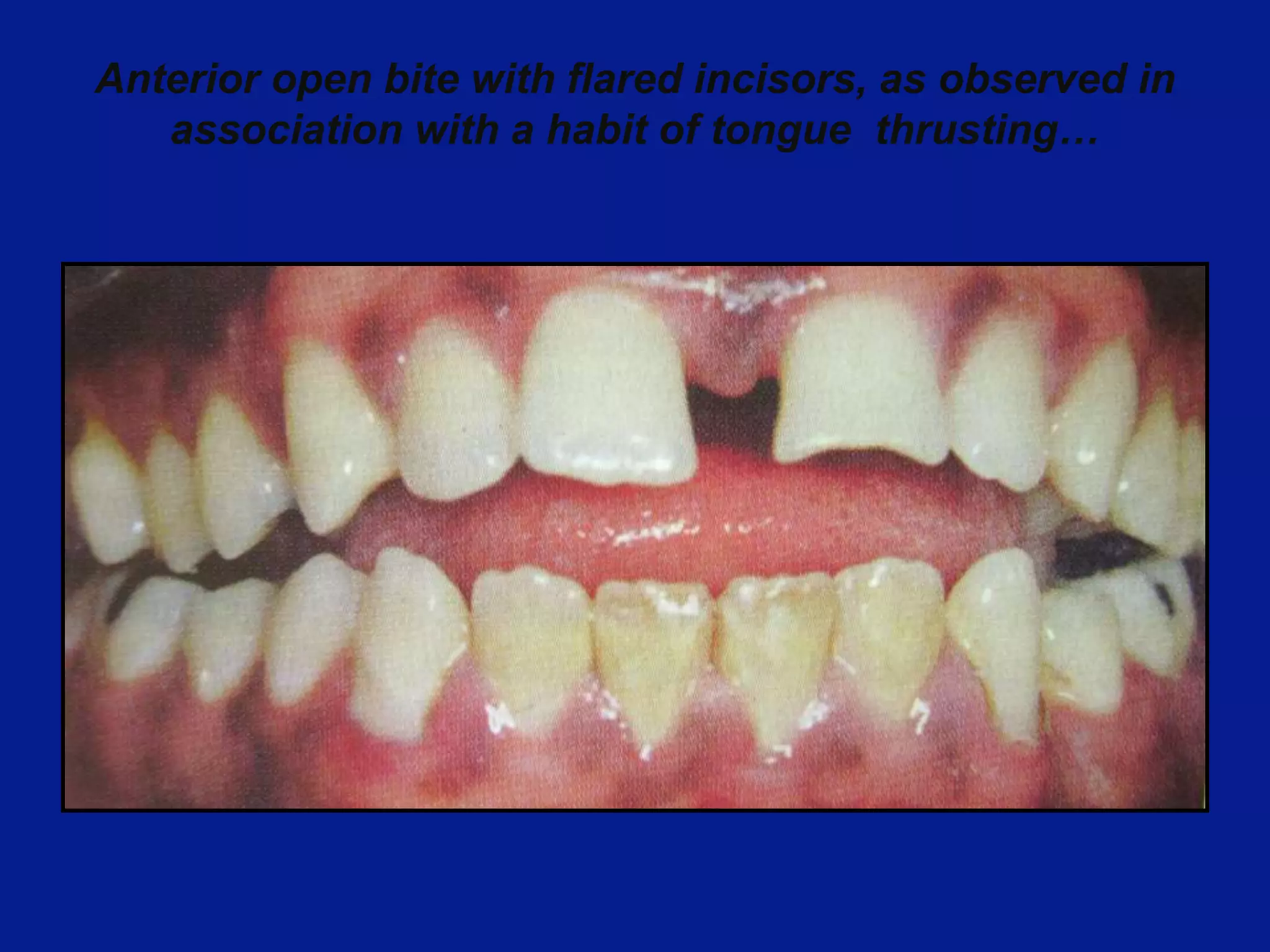 16.Role of dental calculus.ppt