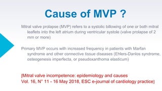 16. MVP EDS.ppt