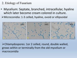 16.fusarium wilt of cotton lantril det.pdf