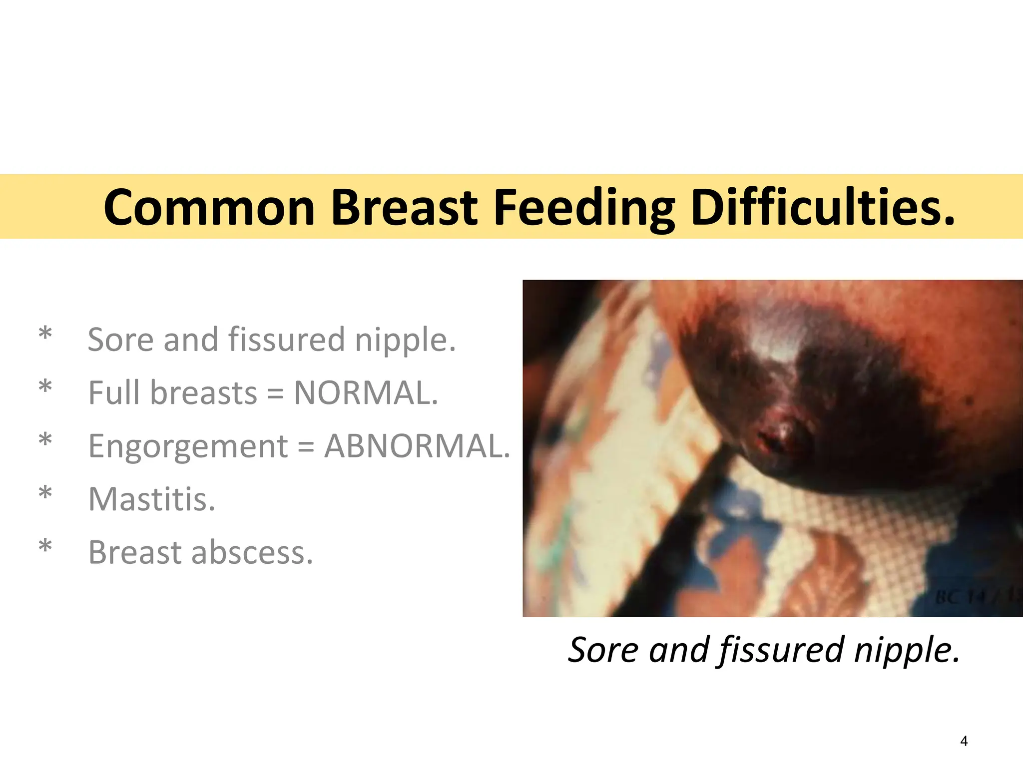 16.0. Overcoming Difficulties in breastfeeding.pptx