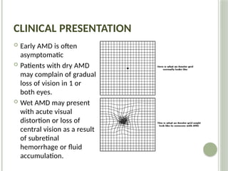 16.10.2012-AN OVERVIEW OF AMD AND IT'S TREATMENT.pptx