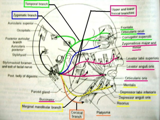 Facial nerve palsy surgical anatomy for human | PPT