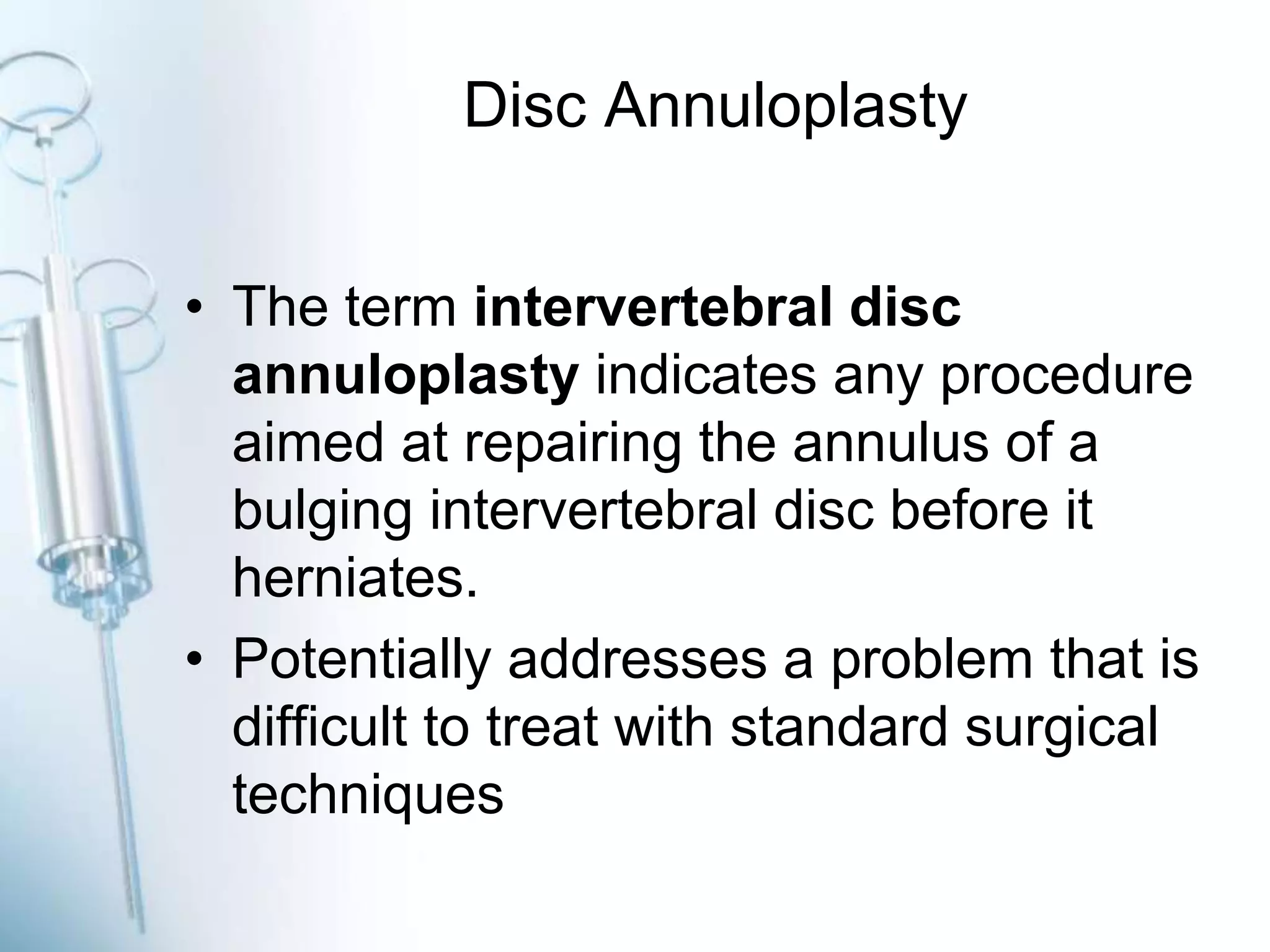 16;30 ANDREA annuloplasty.pptx