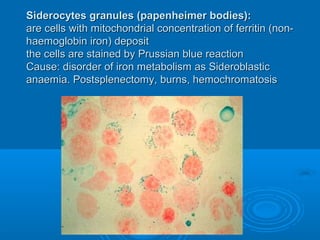 Anemia-laboratorydiagnosis | PPT