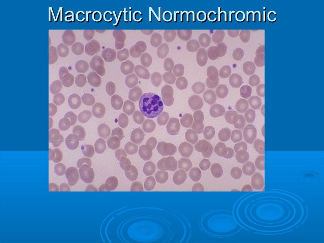 Anemia-laboratorydiagnosis