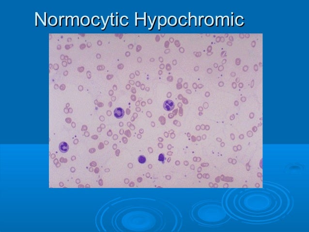 Anemia-laboratorydiagnosis