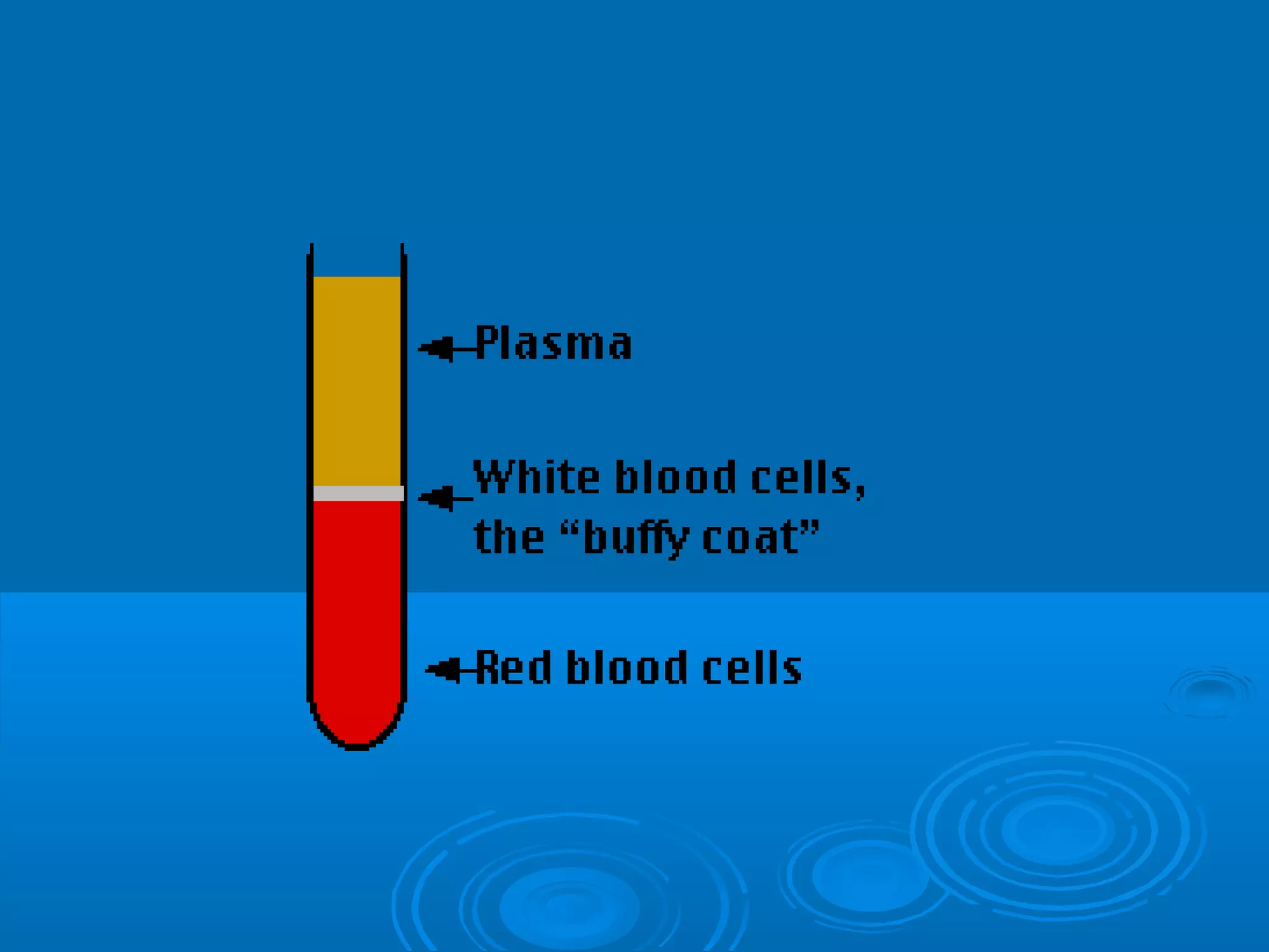 16 anemia-laboratory diagnosis | PPT