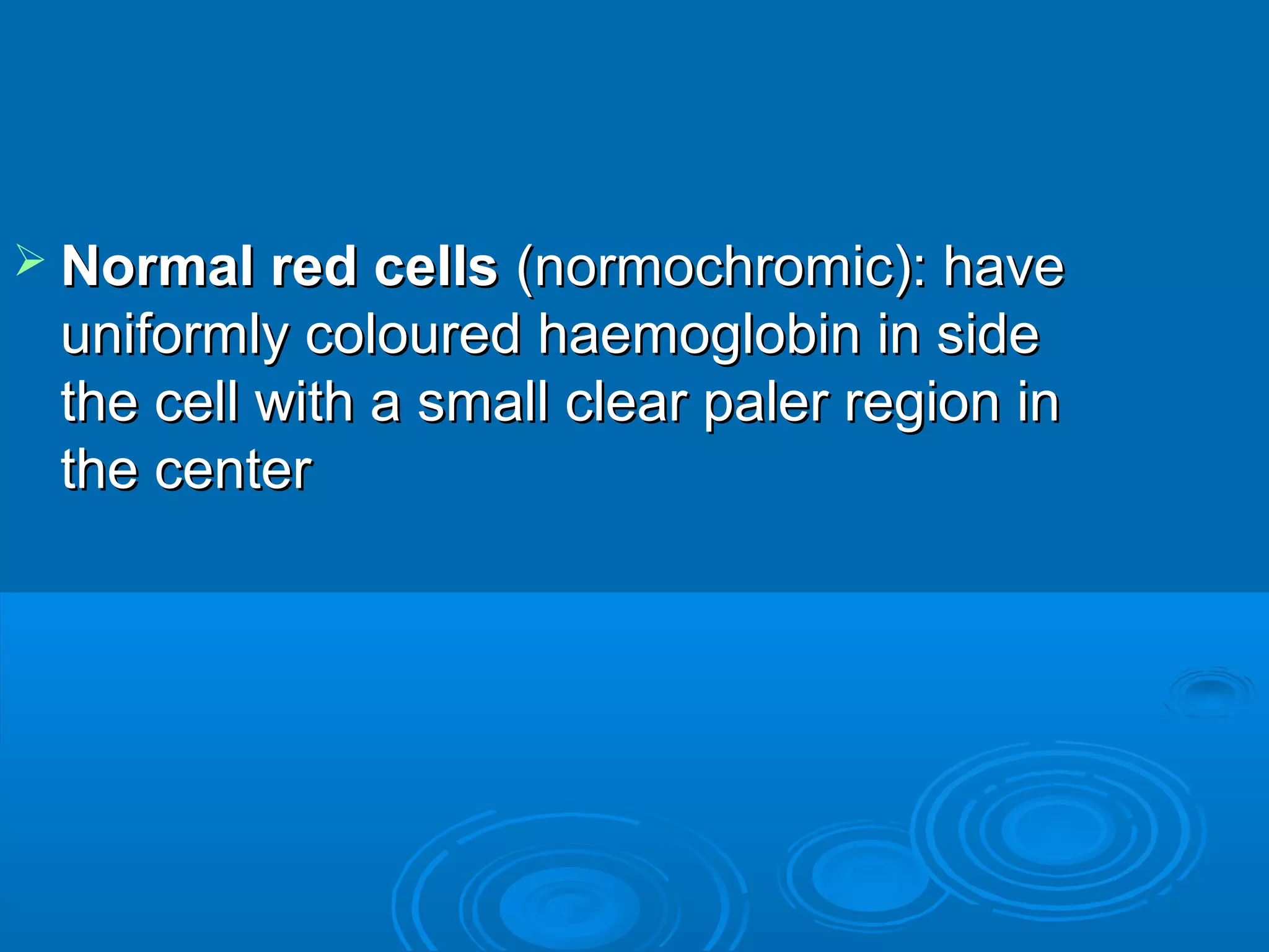 16 anemia-laboratory diagnosis | PPT