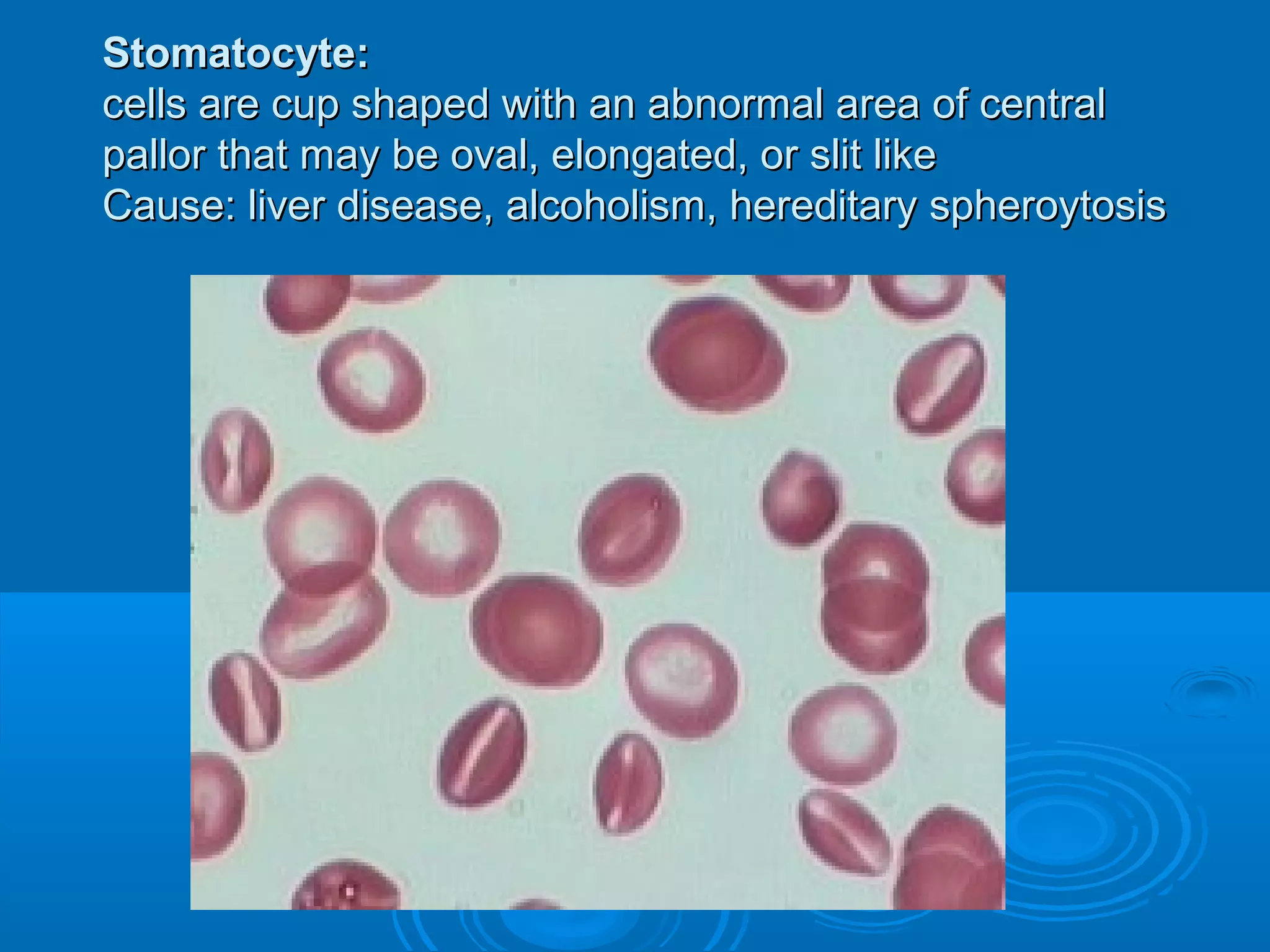 16 anemia-laboratory diagnosis | PPT