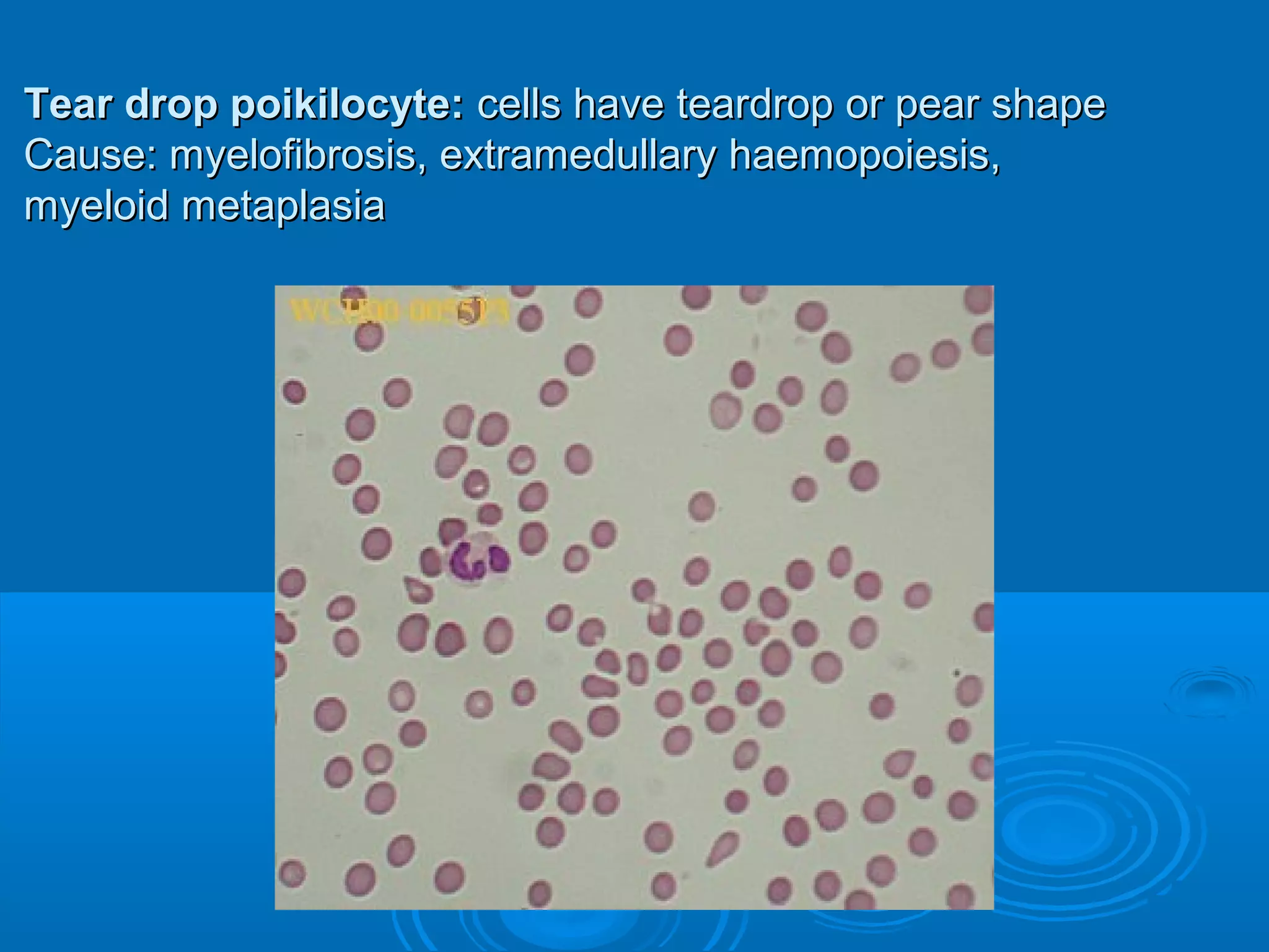 16 anemia-laboratory diagnosis | PPT