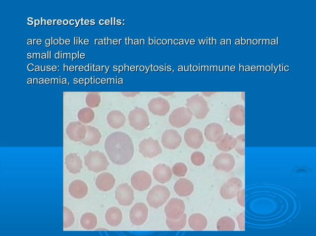 16 anemia-laboratory diagnosis | PPT