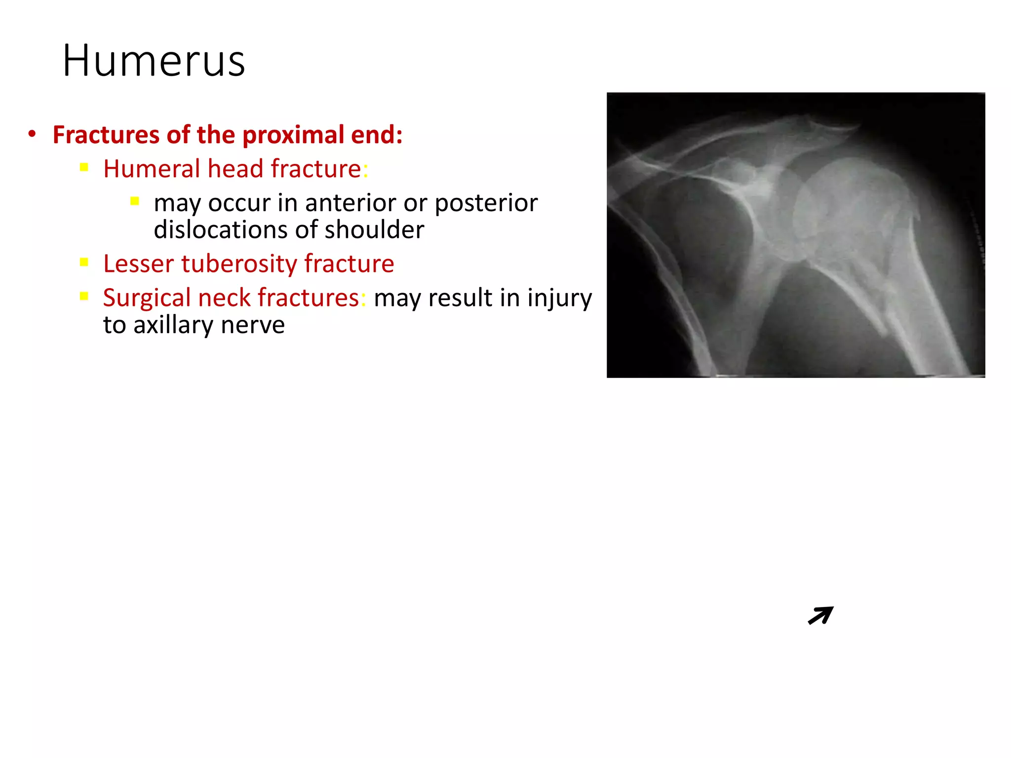 16-Clinical Anatomy of The Upper Limb - Dr Akalanka Jayasinghe.pdf