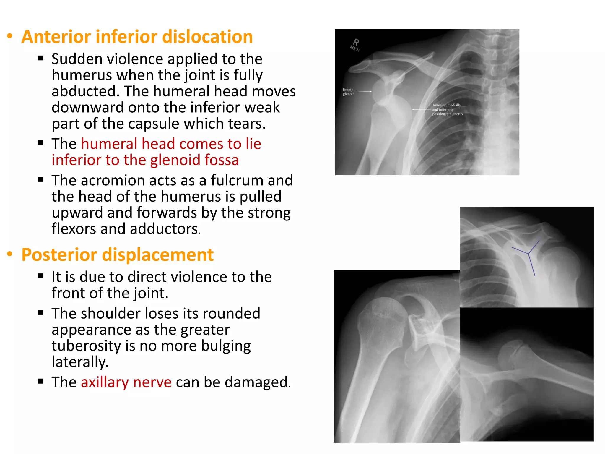16-Clinical Anatomy of The Upper Limb - Dr Akalanka Jayasinghe.pdf