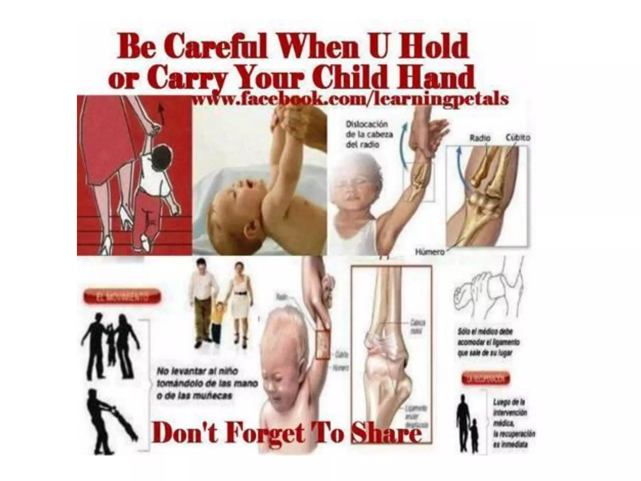 16-Clinical Anatomy of The Upper Limb - Dr Akalanka Jayasinghe.pdf