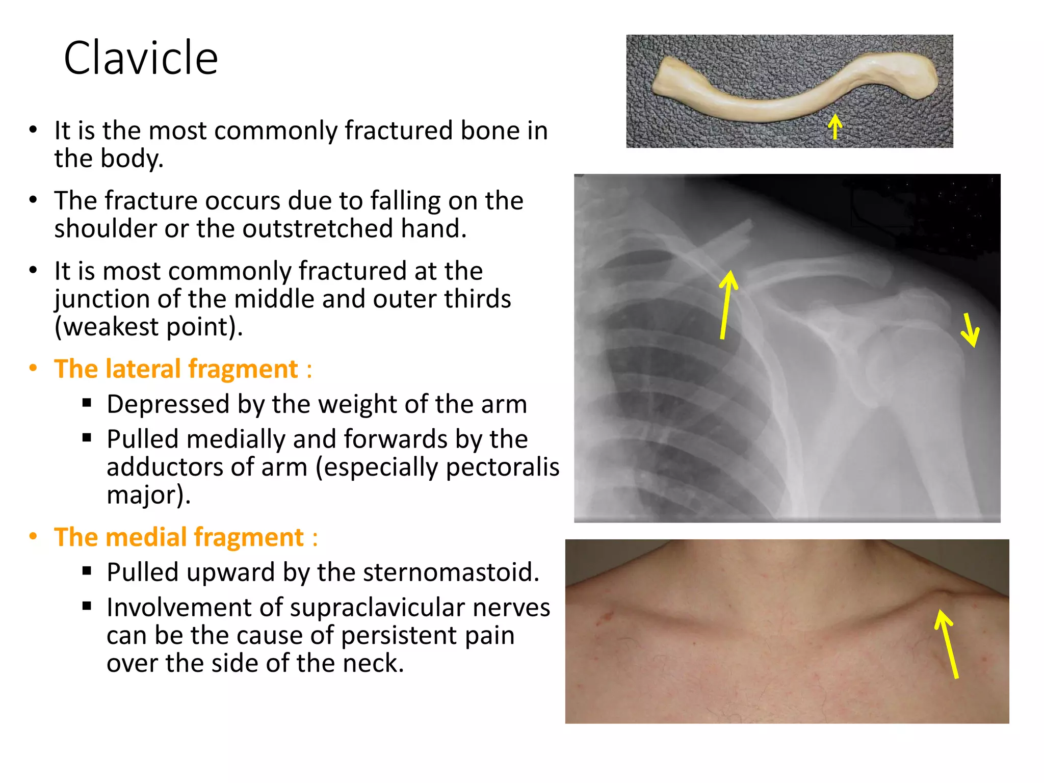 16-Clinical Anatomy of The Upper Limb - Dr Akalanka Jayasinghe.pdf