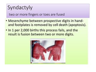 16-Clinical Anatomy of The Upper Limb - Dr Akalanka Jayasinghe.pdf