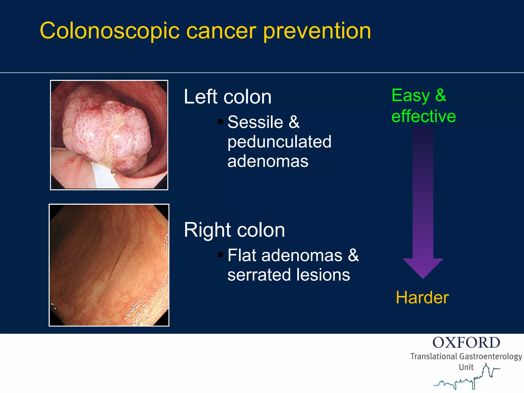 Endoscopy in Gastrointestinal Oncology - Slide 16 - J. East ...