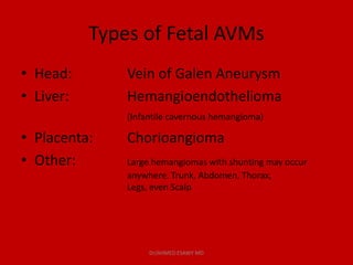 16-fetal vascular malformations imaging Dr Ahmed Esawy | PDF