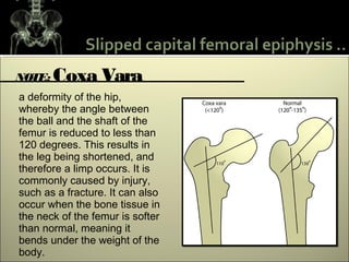 16 hip disorders - d3 | PPT