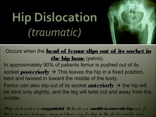 16 hip disorders - d3 | PPT