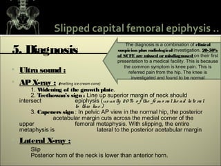 16 hip disorders - d3 | PPT