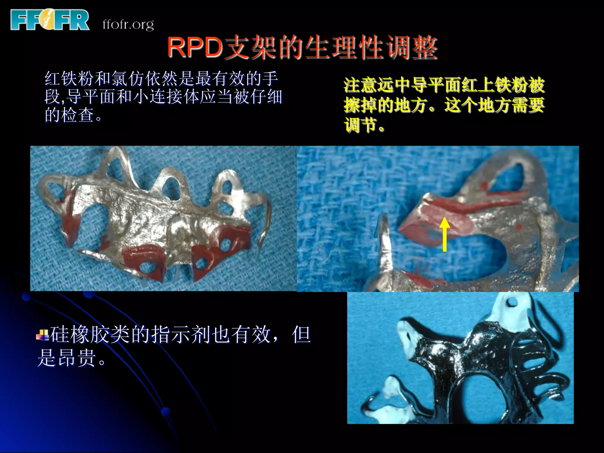 16.mfp defects and rpd design | PPT
