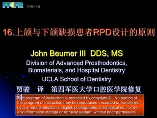 16.mfp defects and rpd design | PPT