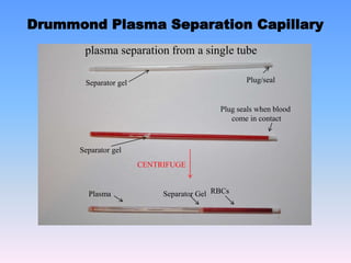 16 microsampling tools for quantitative dried matrix spotting joe siple ...