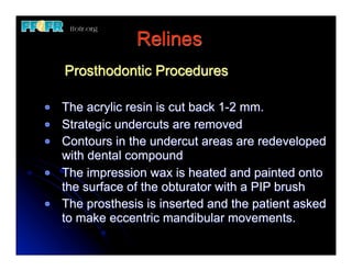 16. (new)maxillary obturators trouble shooting, relines and other ...