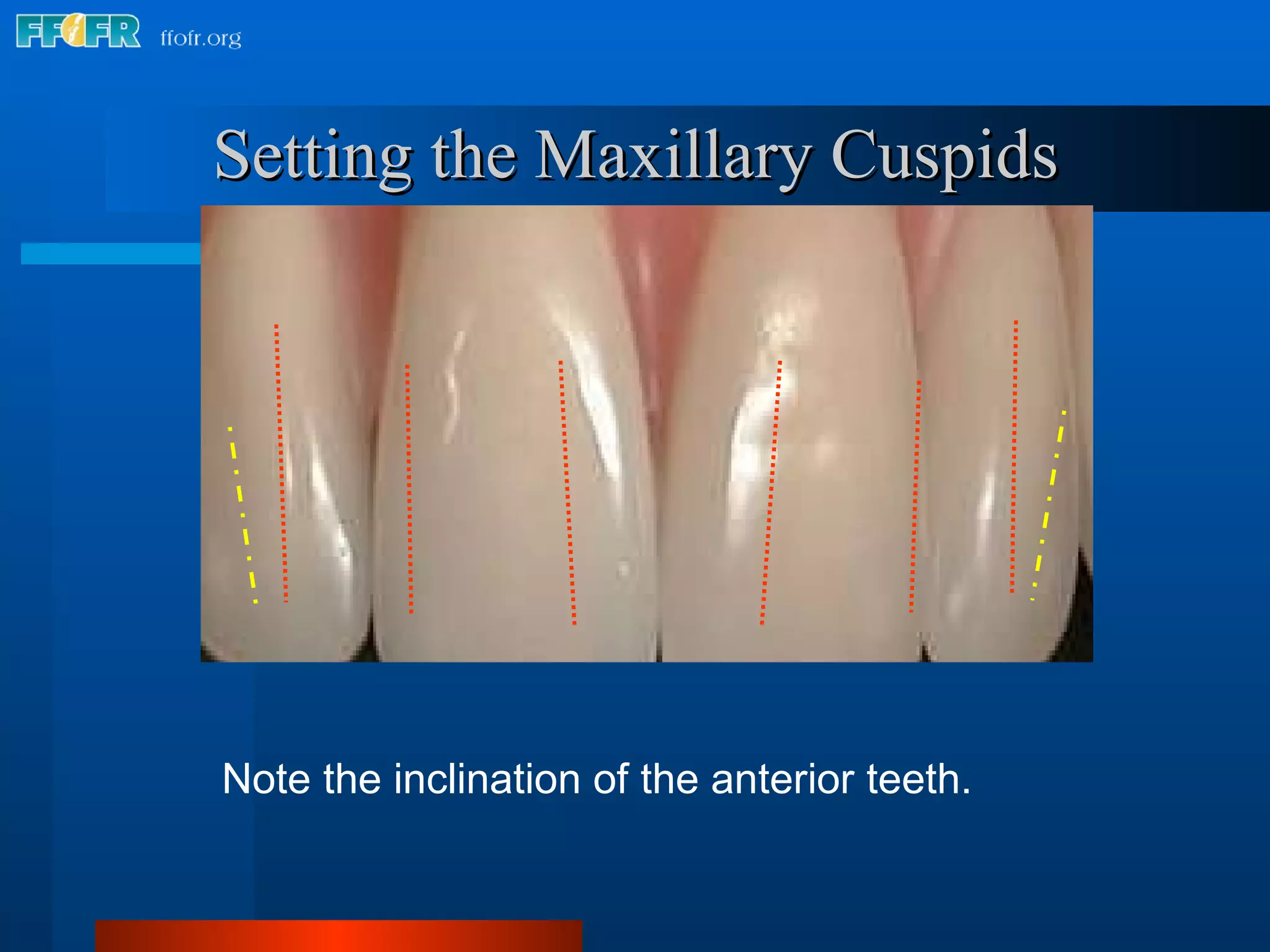 16.occlusal schemes lingualized occlusion | PPT