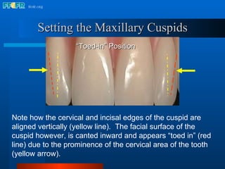 16.occlusal schemes lingualized occlusion | PPT