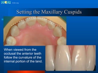16.occlusal schemes lingualized occlusion | PPT