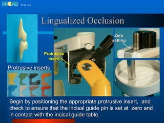 16.occlusal schemes lingualized occlusion | PPT