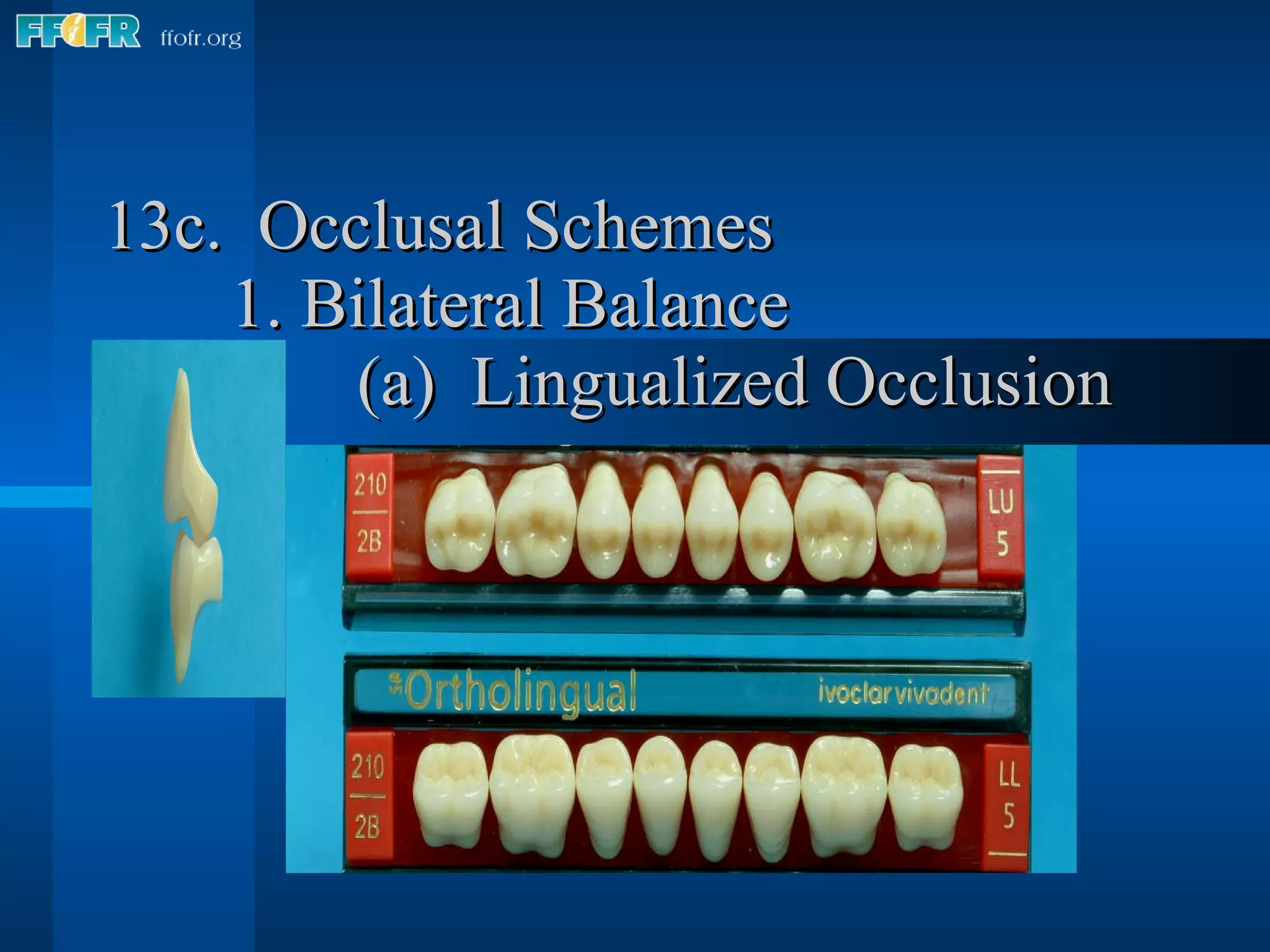 16.occlusal schemes lingualized occlusion | PPT