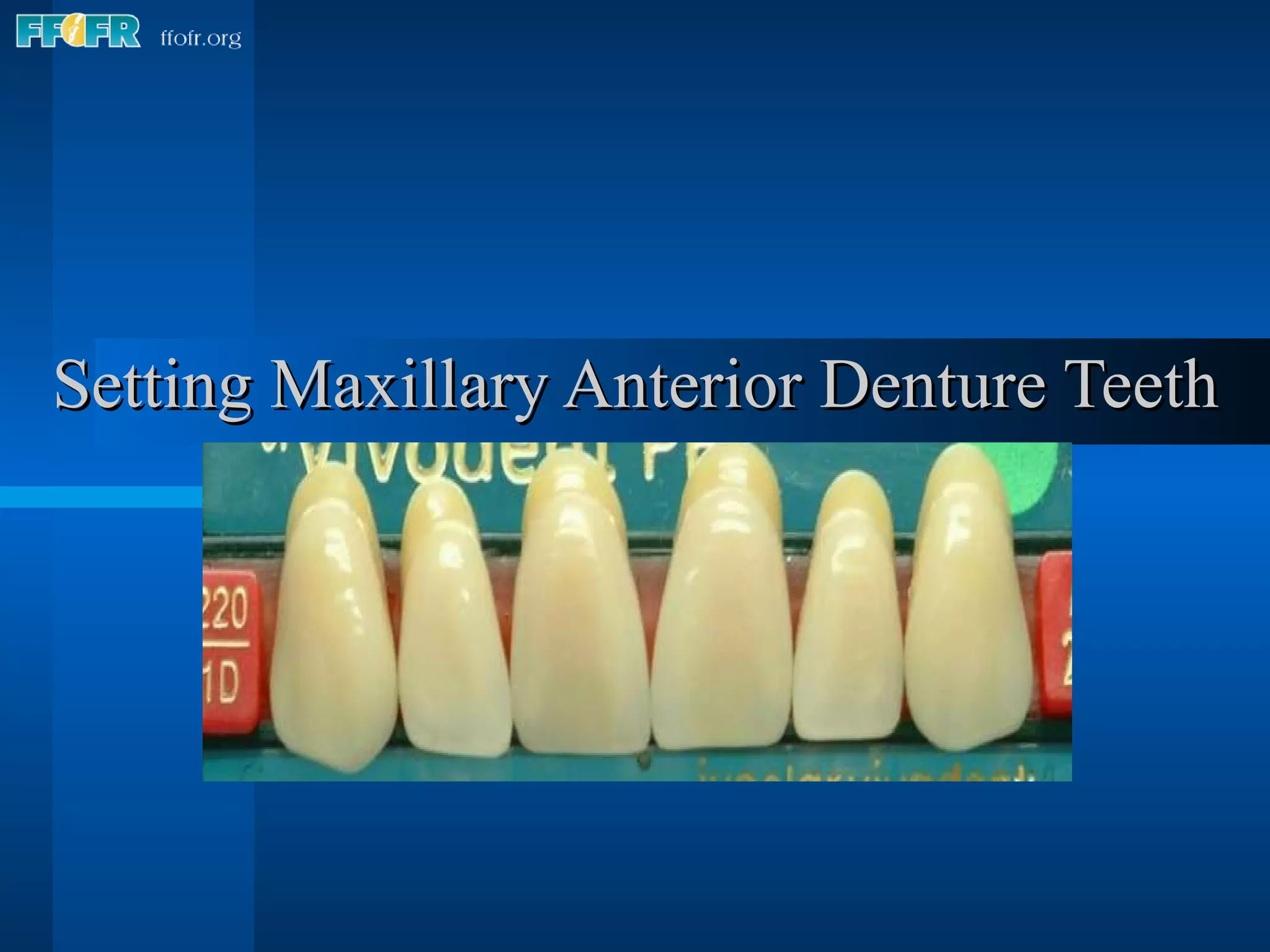 16.occlusal schemes lingualized occlusion | PPT