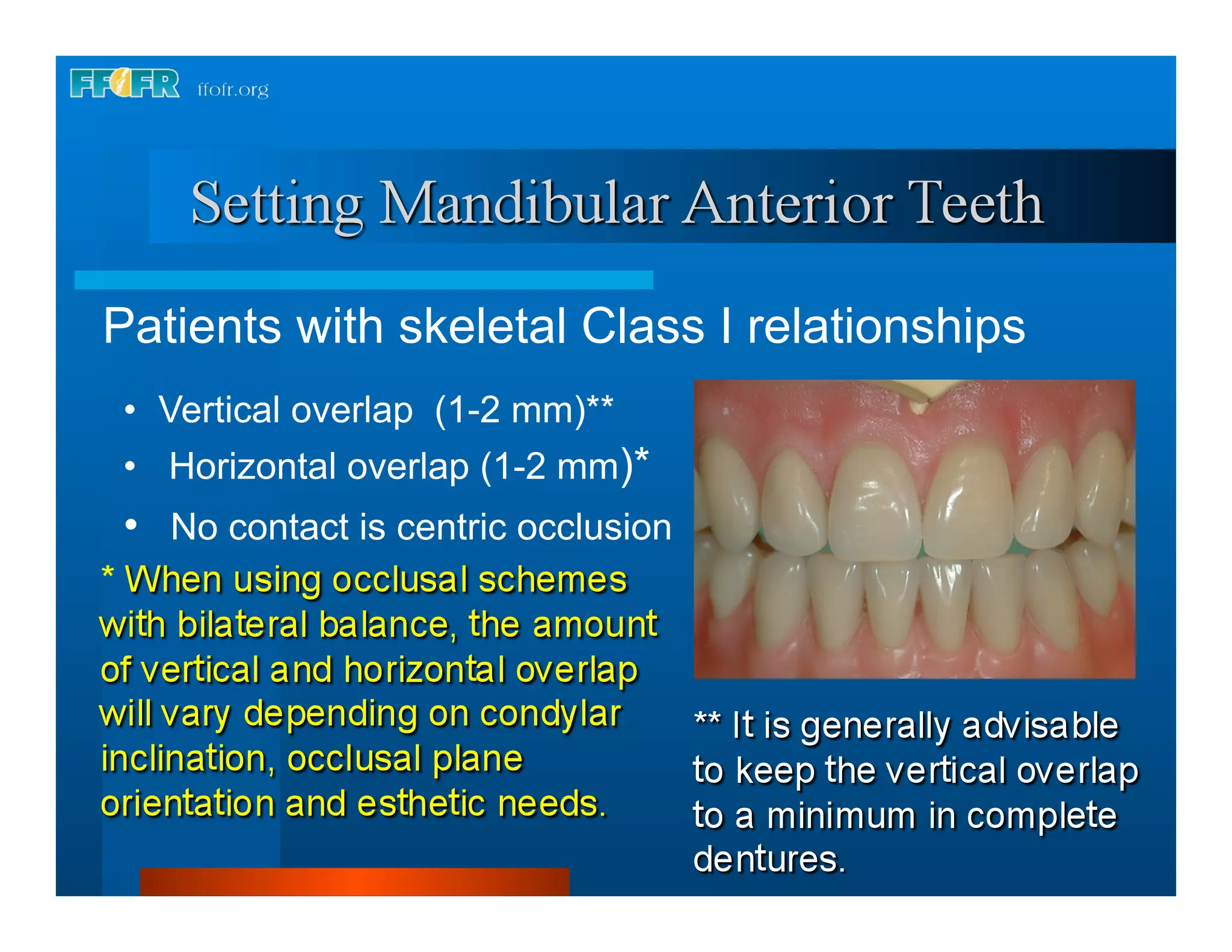 16.occlusal schemes lingualized occlusion | PDF