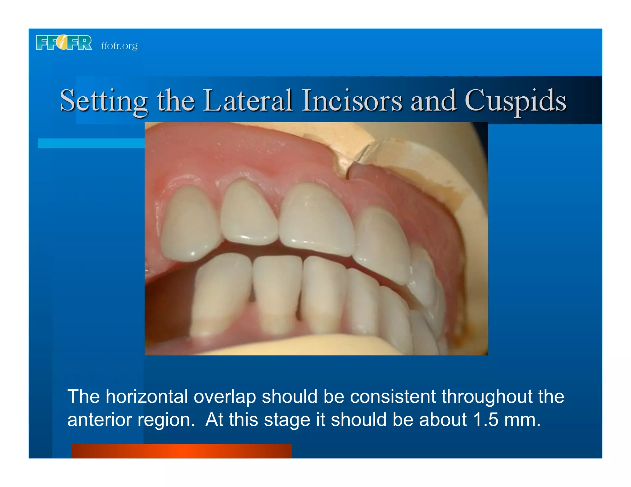 16.occlusal schemes lingualized occlusion | PDF