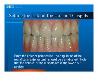 16.occlusal schemes lingualized occlusion | PDF