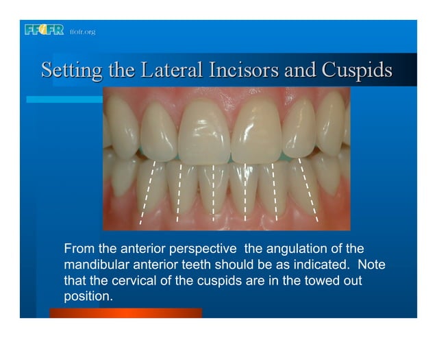 16.occlusal schemes lingualized occlusion | PDF